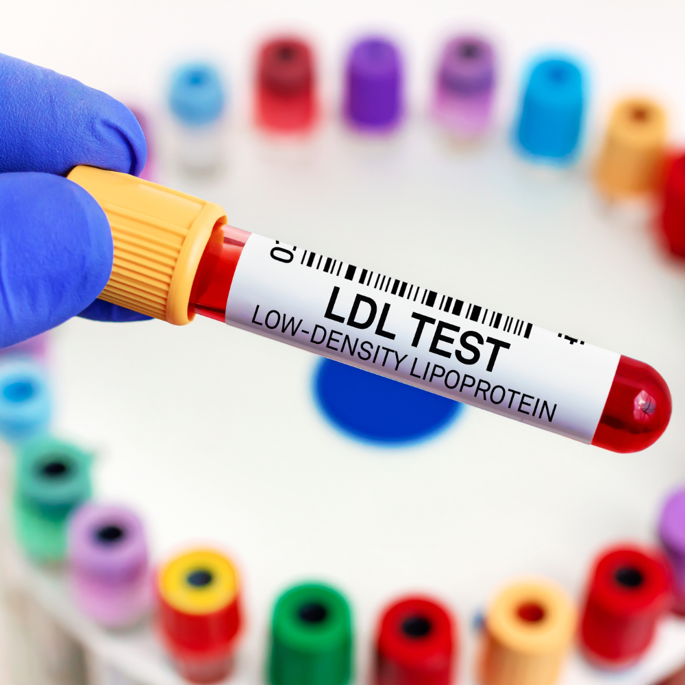 Managing Cholesterol Is Bigger Than Just LDL Alone